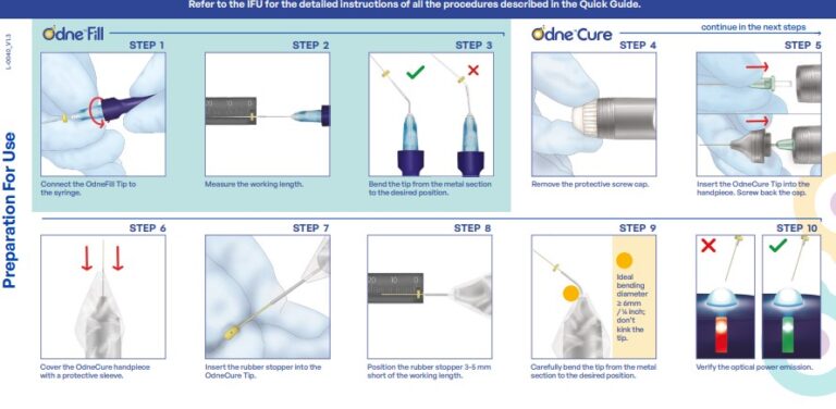 Odne Fill/Cure Quick Guide - Odne