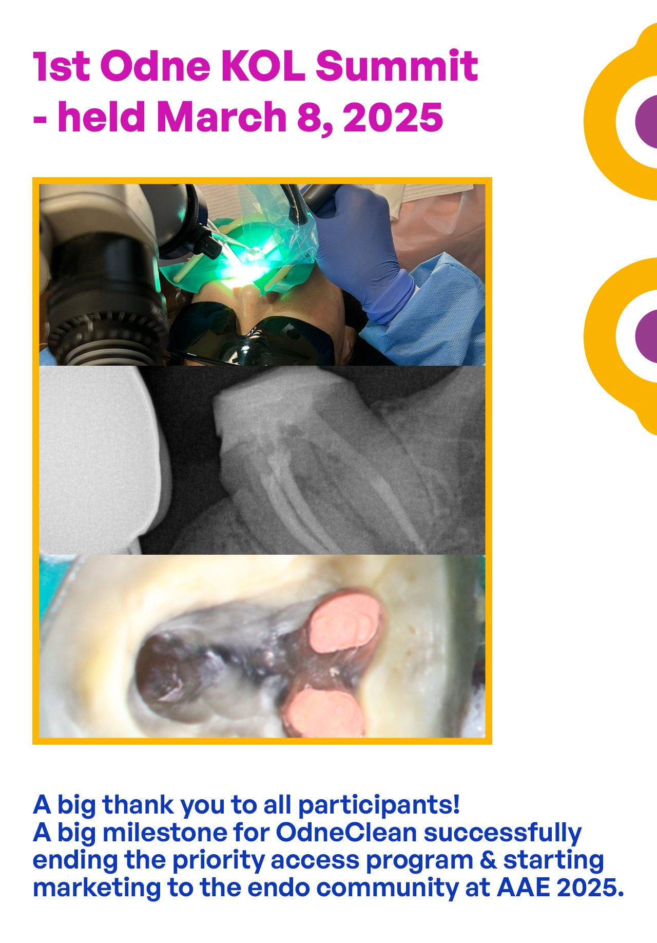 Transforming Endo - Odne